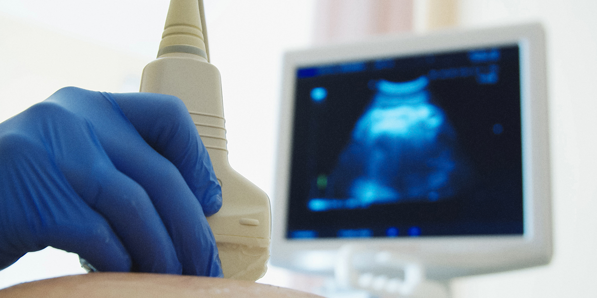 All About IVF Monitoring — GoStork