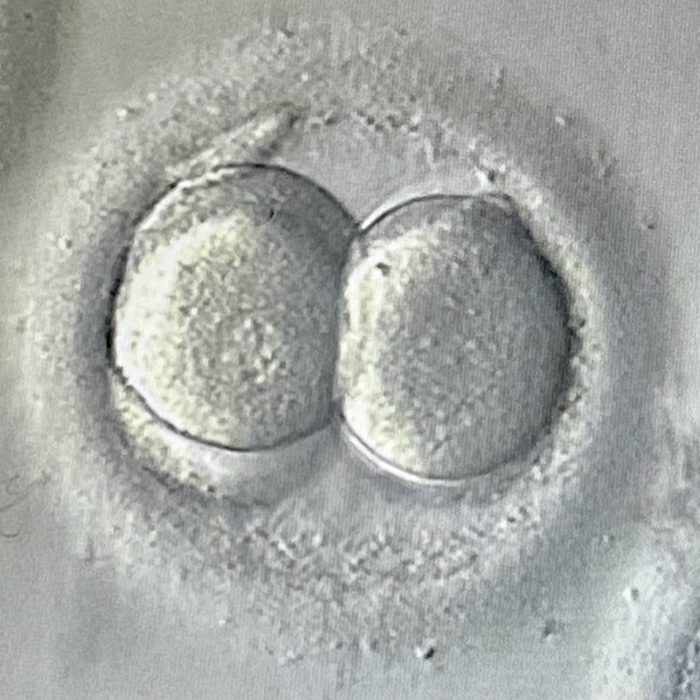 All About Embryo Development — GoStork